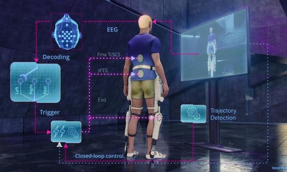 ‘First-of-its-kind’ major neurotech hub announced in Milan - Neuro ...